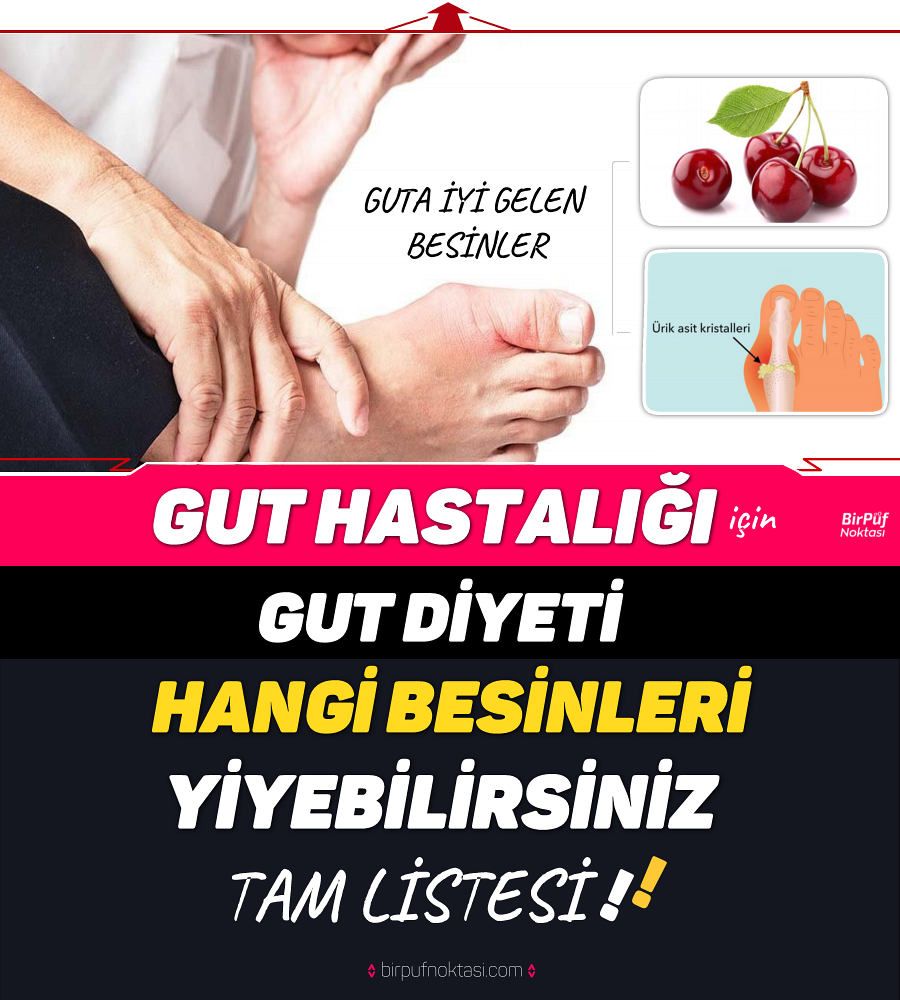 GUT HASTALIĞI NEDİR, GUT DİYETİ - Bir Püf Noktası